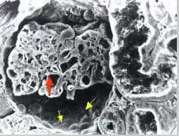 Biology-kidney's nephrons